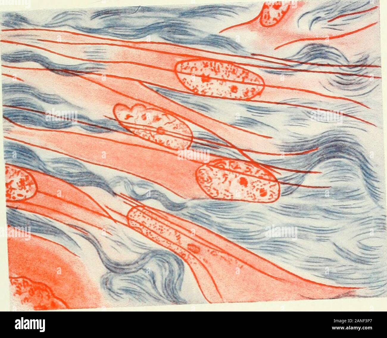 Fibroids and allied tumours (myoma and adenomyoma) : their pathology ...