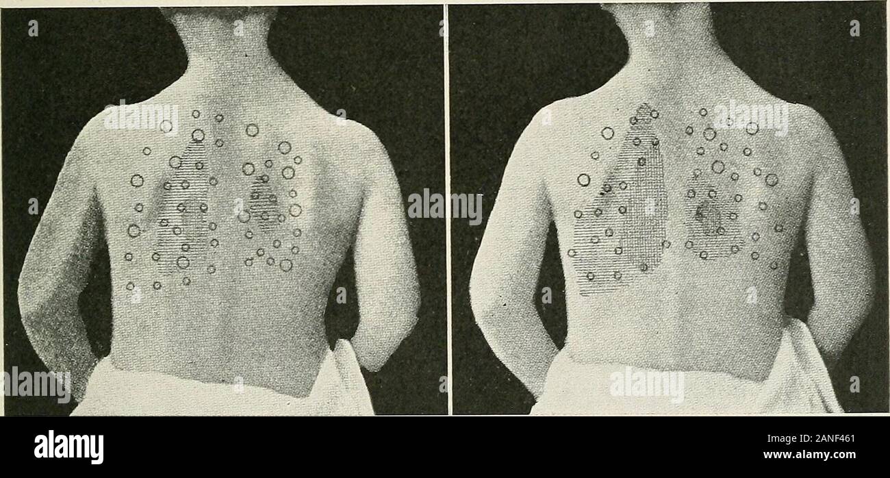Diseases of the chest and the principles of physical diagnosis . Fig ...