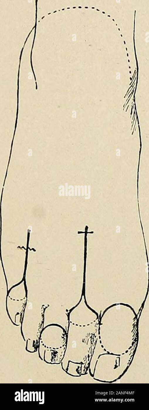 Neuromata hi-res stock photography and images - Alamy