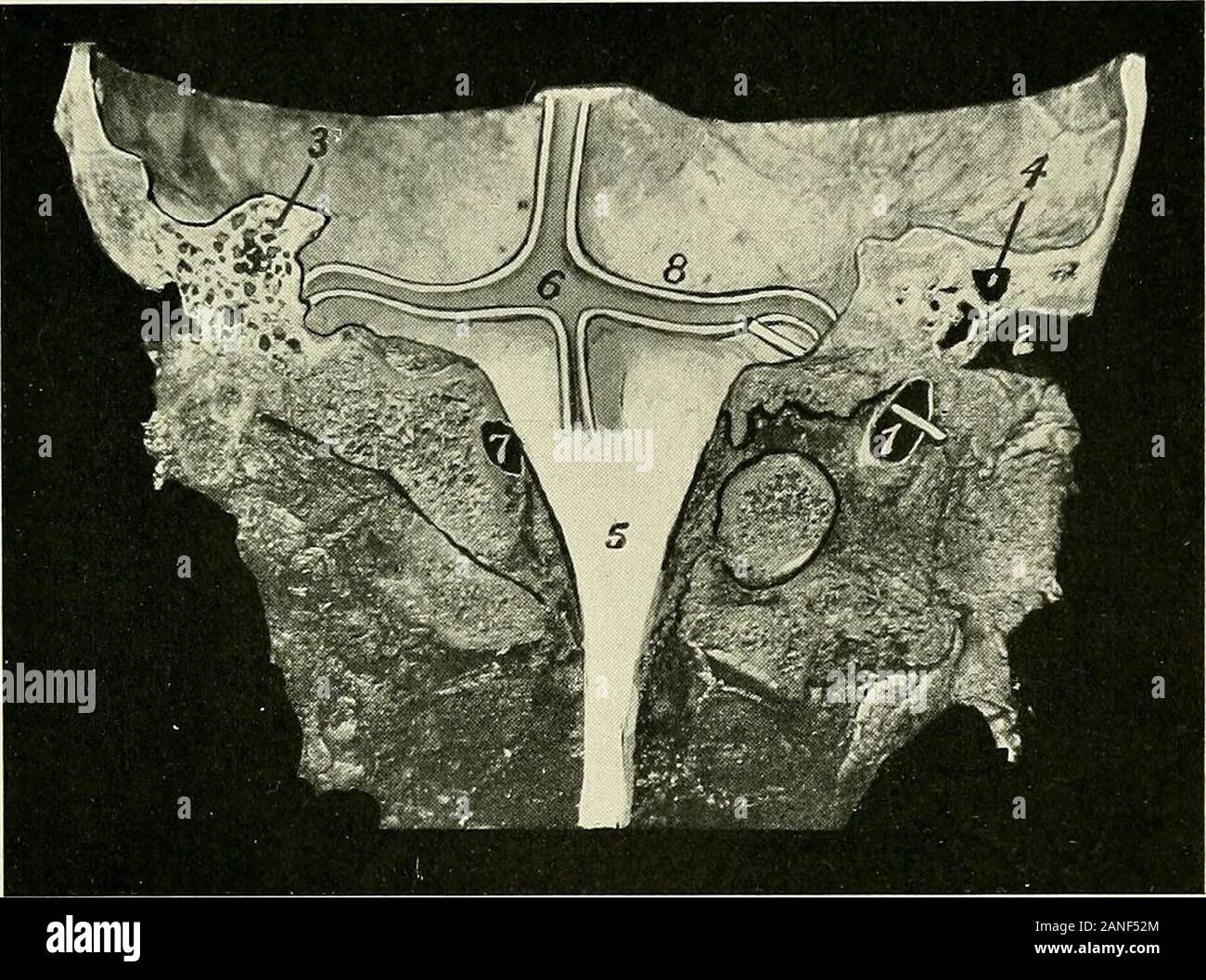 Membrana cerebral hi-res stock photography and images - Alamy