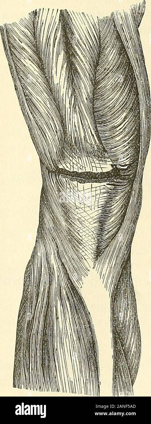 A practical treatise on fractures and dislocations . Stellate fracture ...