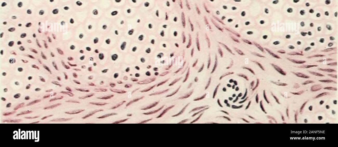 Fibroids and allied tumours (myoma and adenomyoma) : their pathology ...