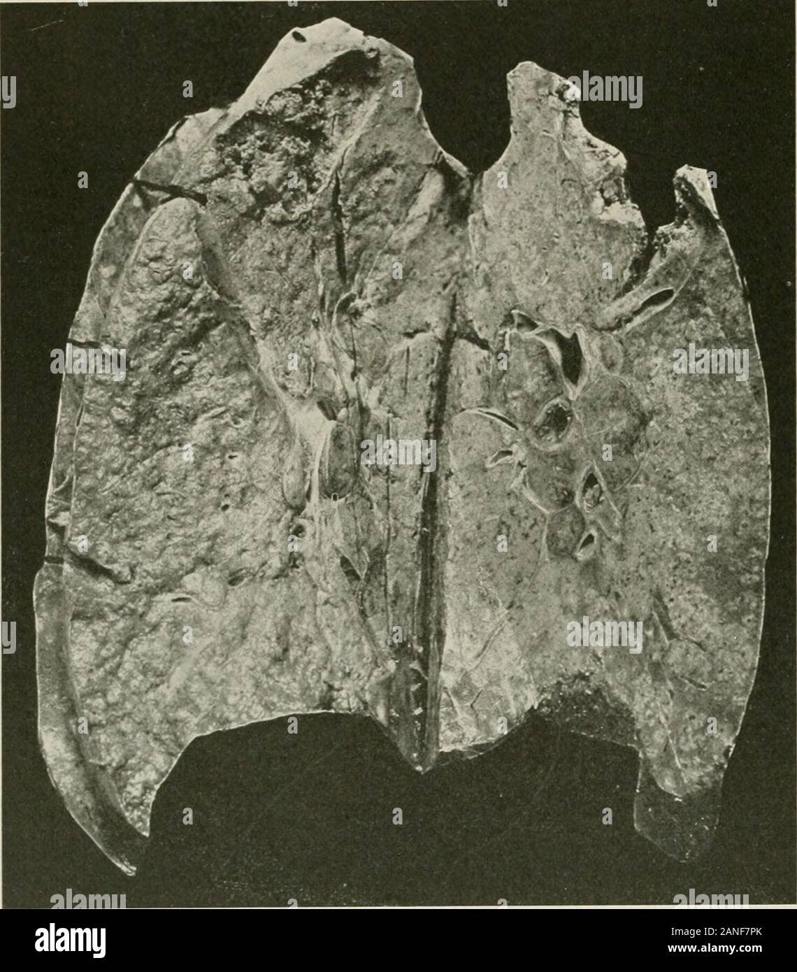Diseases of the chest and the principles of physical diagnosis . he ...