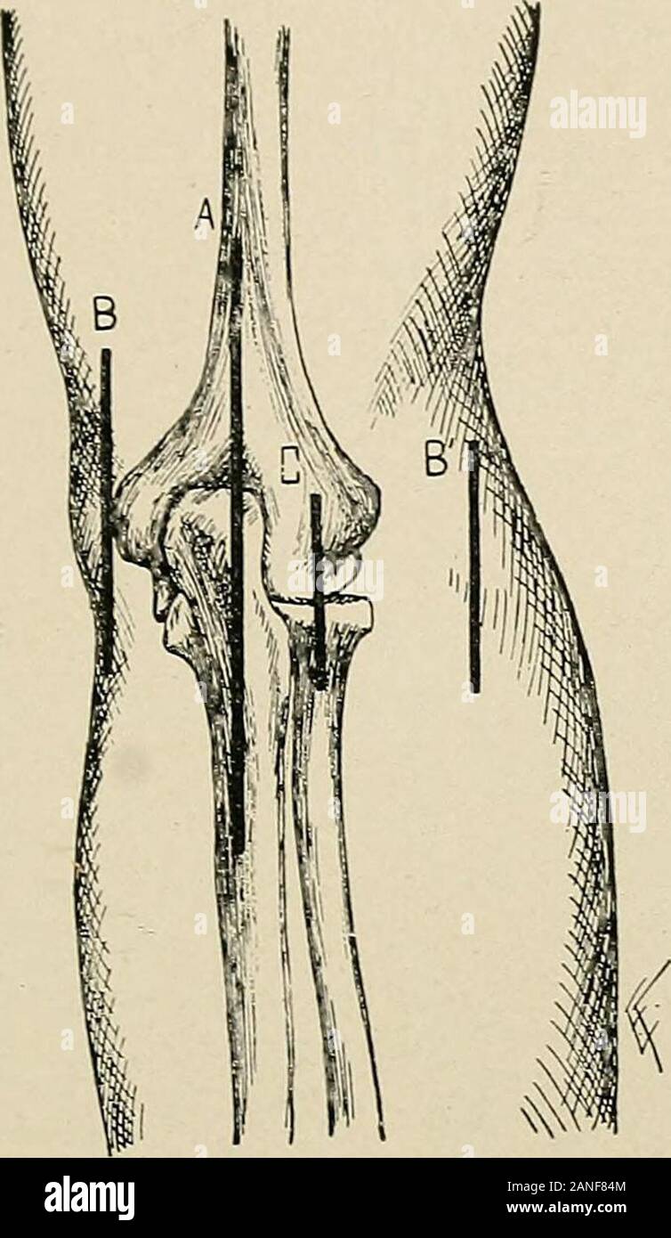 The practice of surgery . - suspicious focus. Our ultimate object in ...