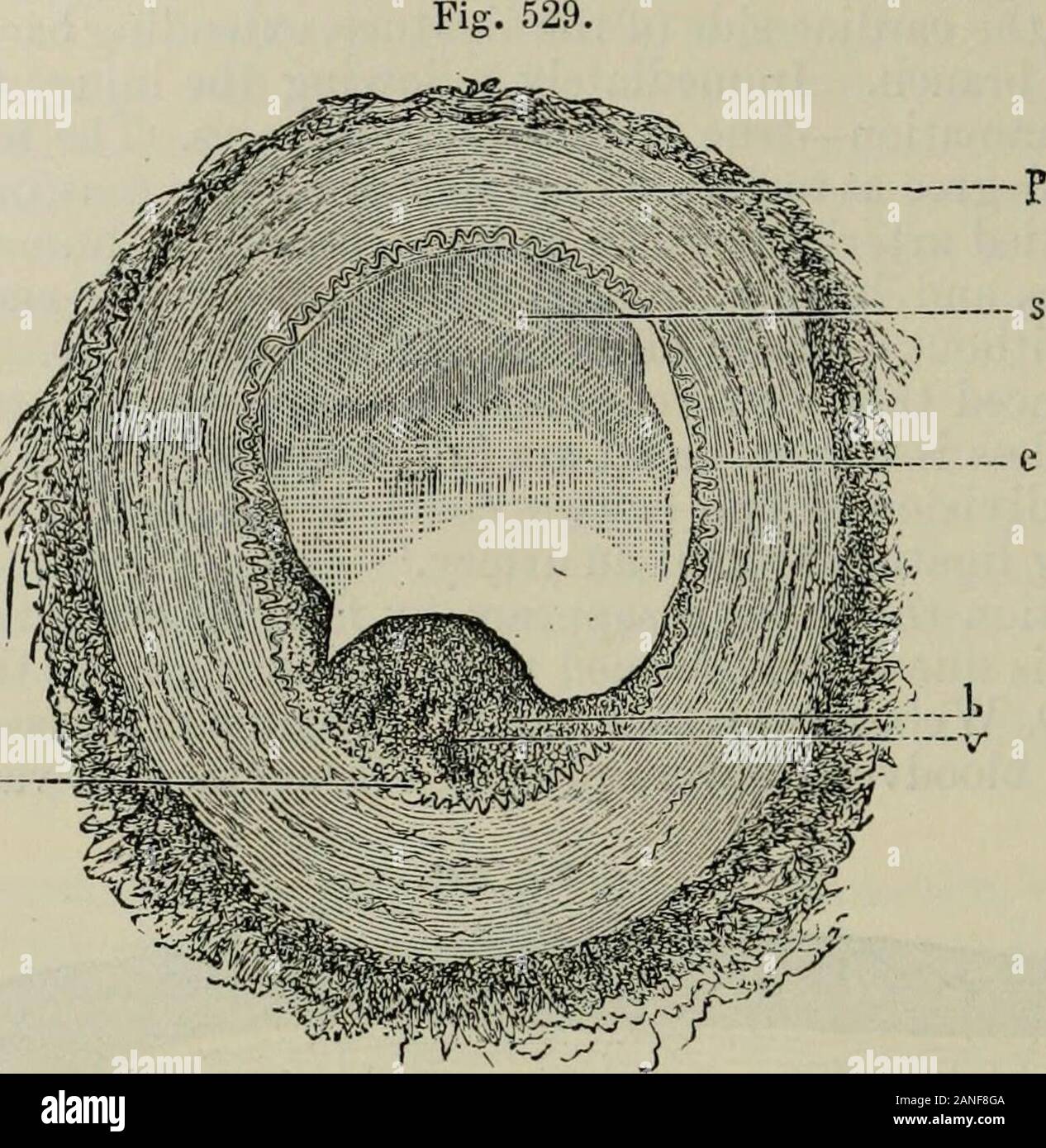 Deadtissue hi-res stock photography and images - Alamy