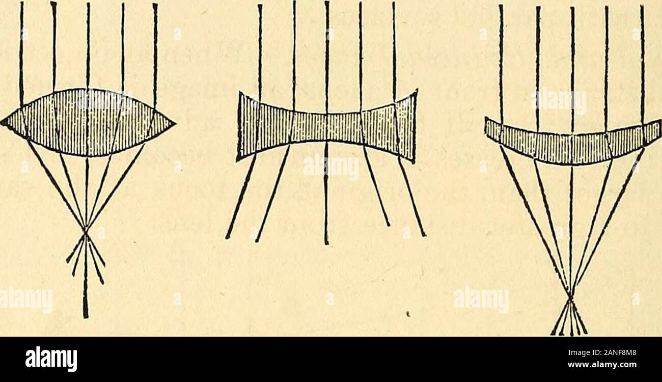 Negative Meniscus Lens