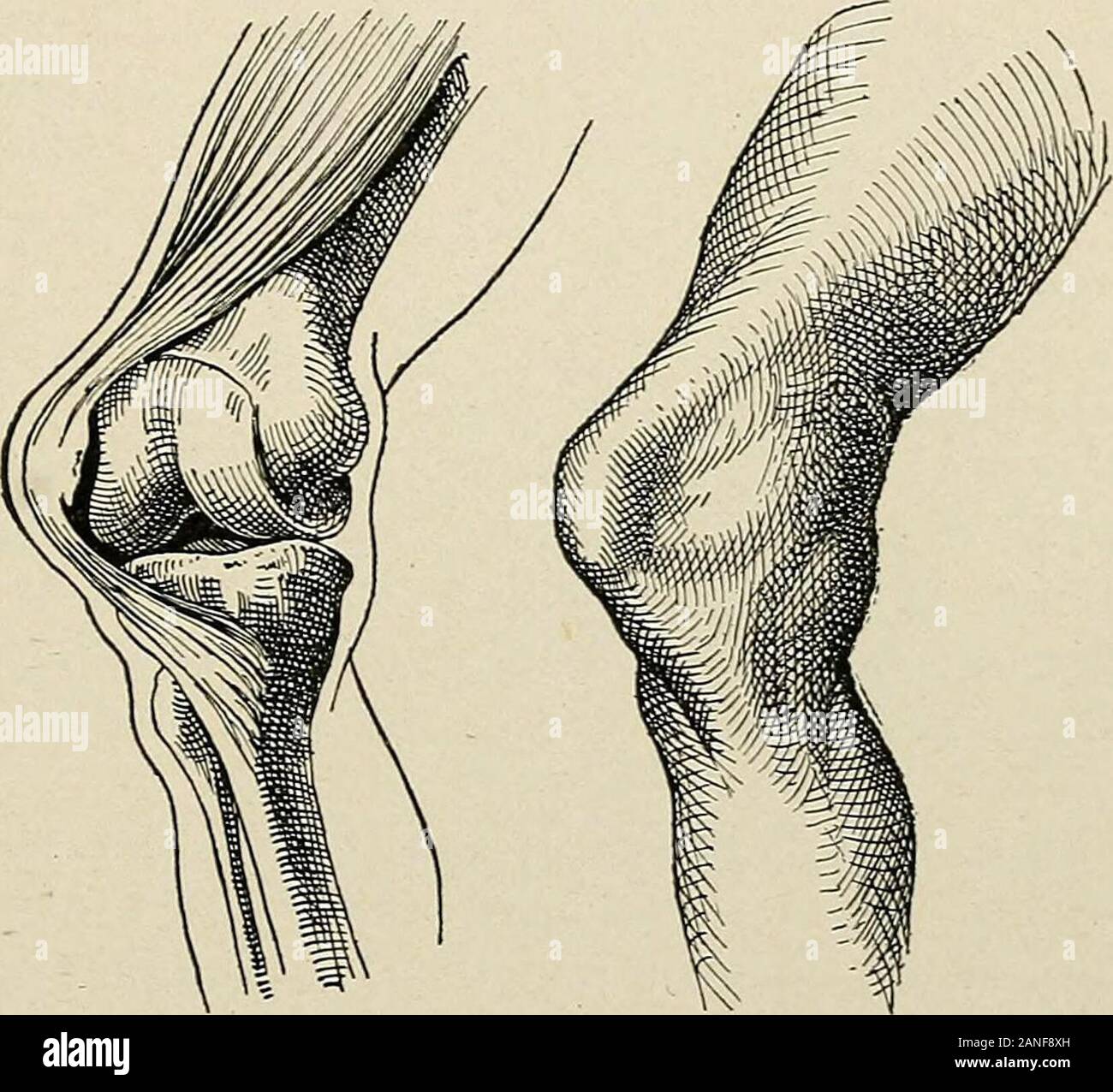 Dislocation patella hi-res stock photography and images - Alamy