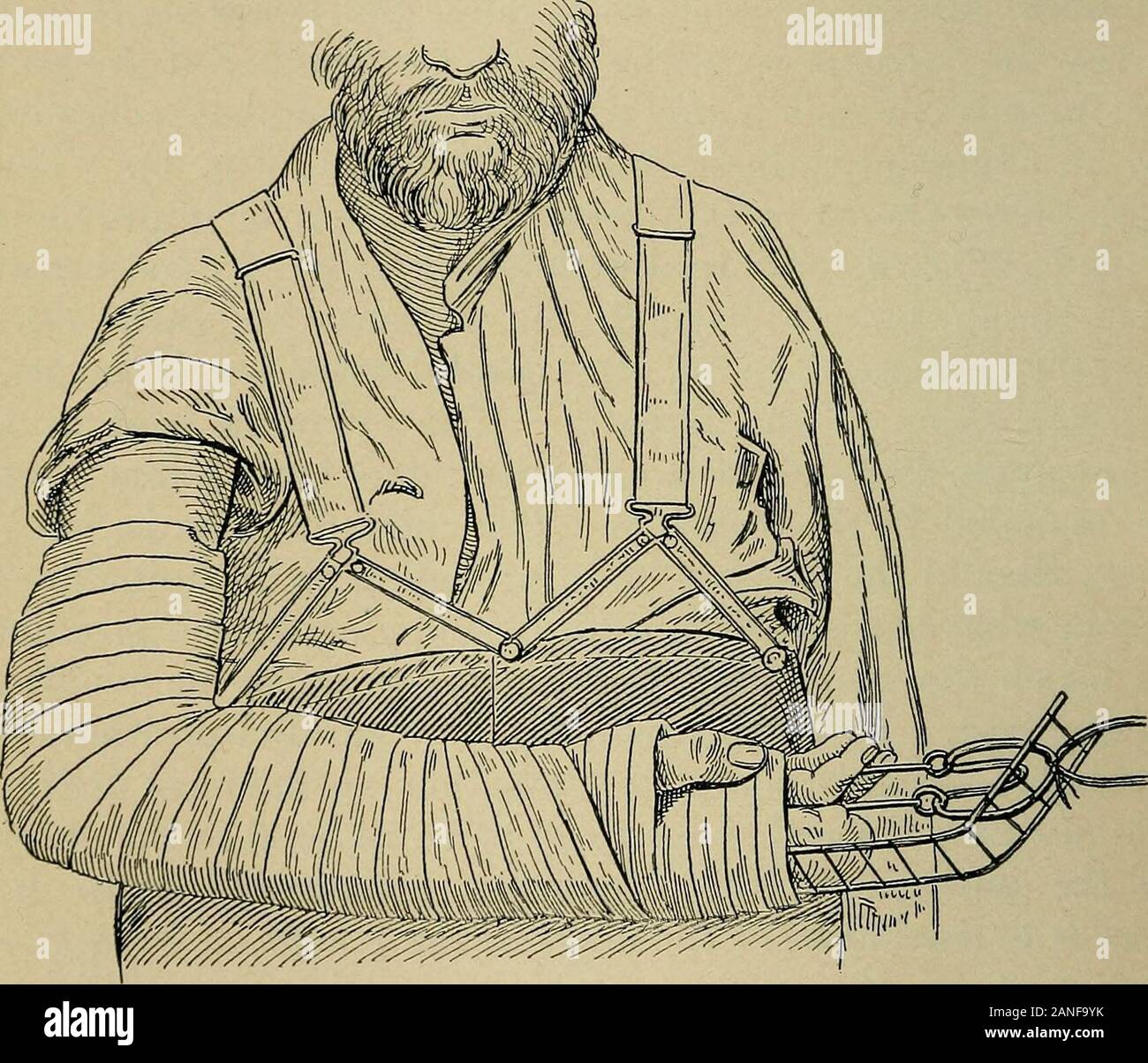 Supinator muscle hi-res stock photography and images - Alamy