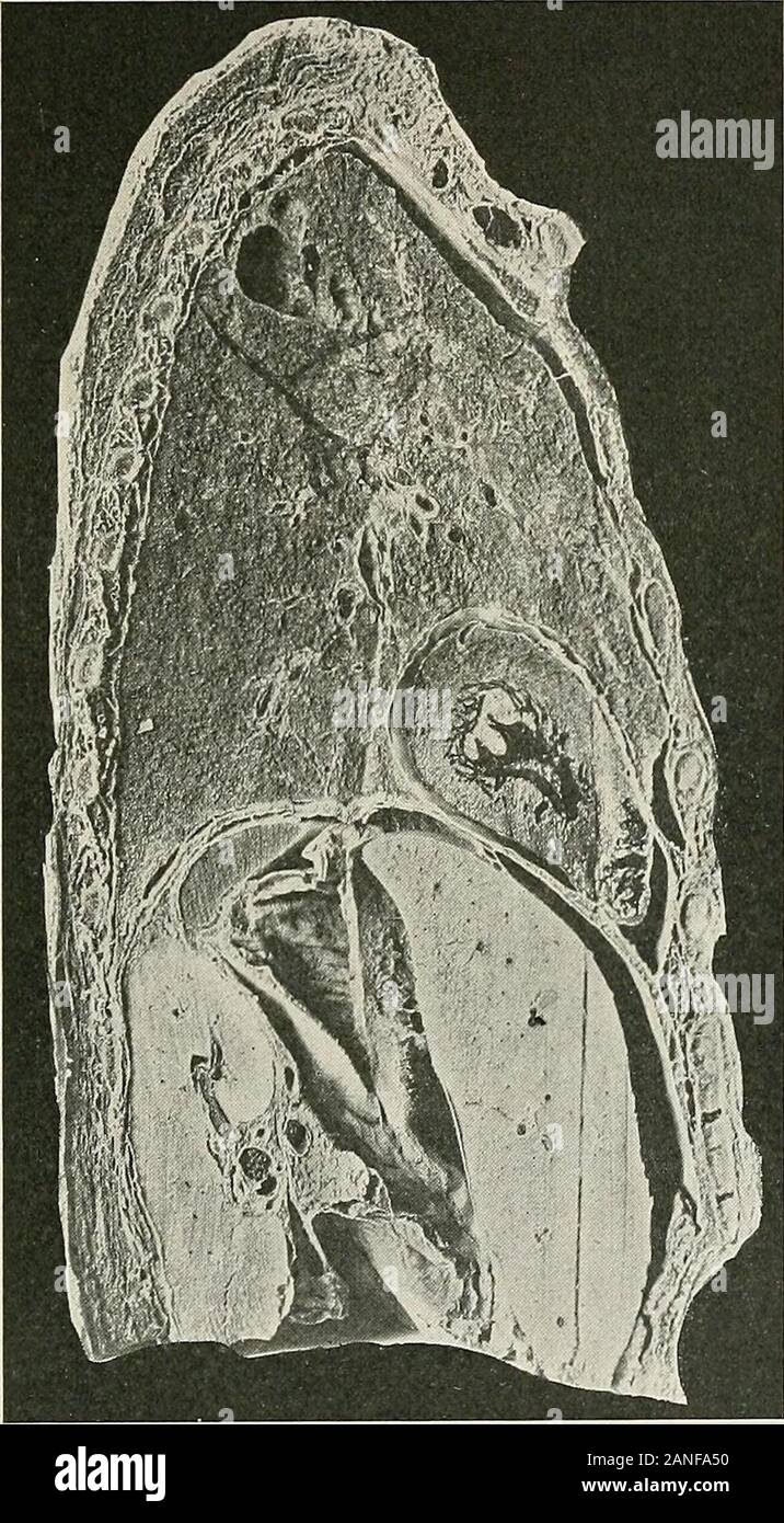 Diseases of the chest and the principles of physical diagnosis ...