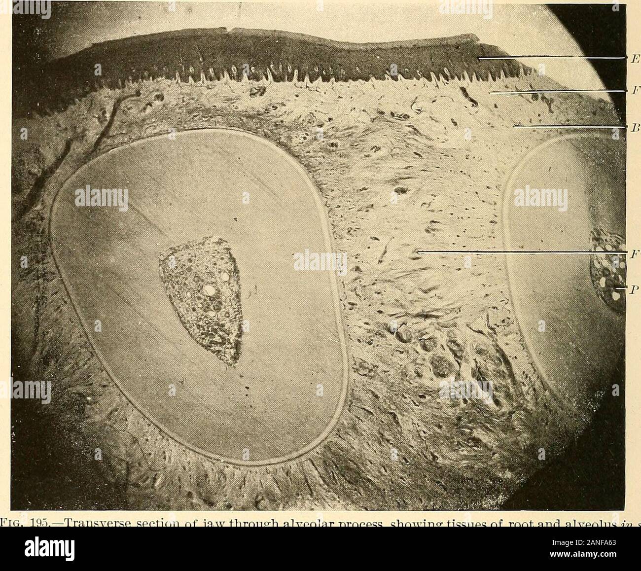 Principles and practice of operative dentistry . Fig. 194.—Transverse ...