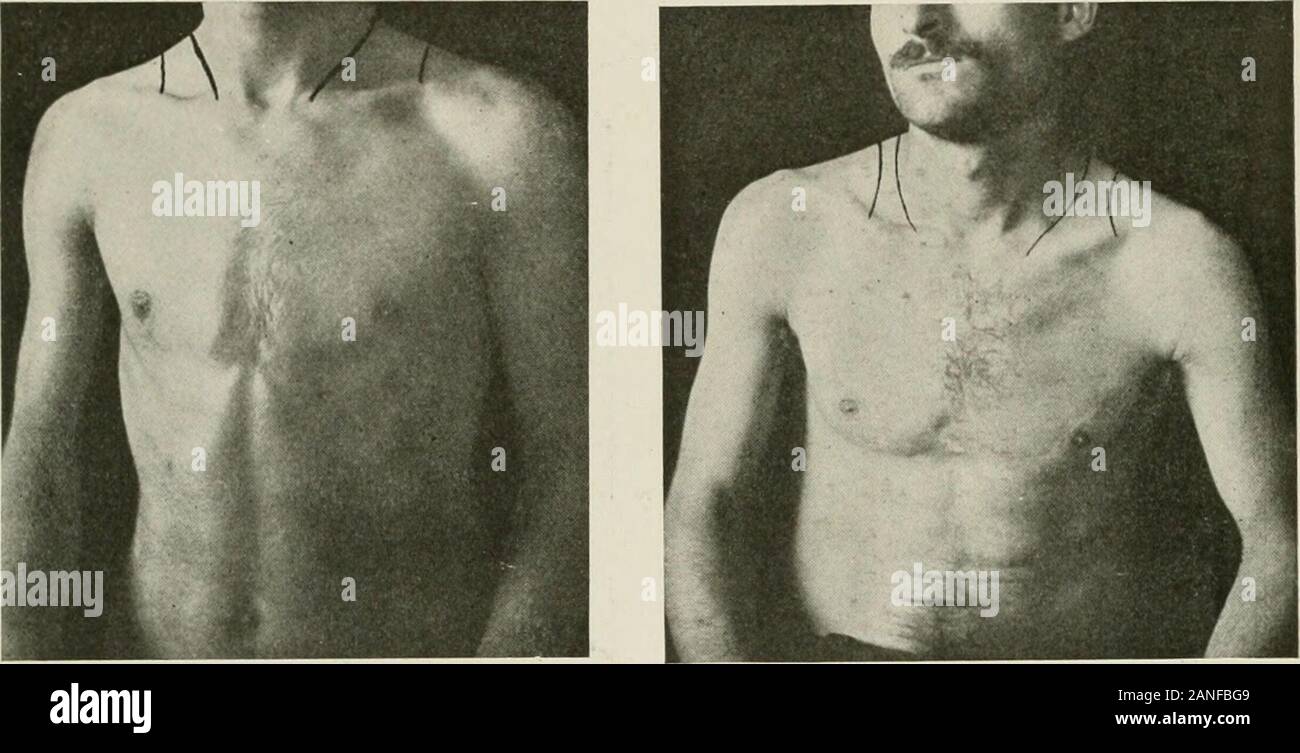 Diseases of the chest and the principles of physical diagnosis . non ...