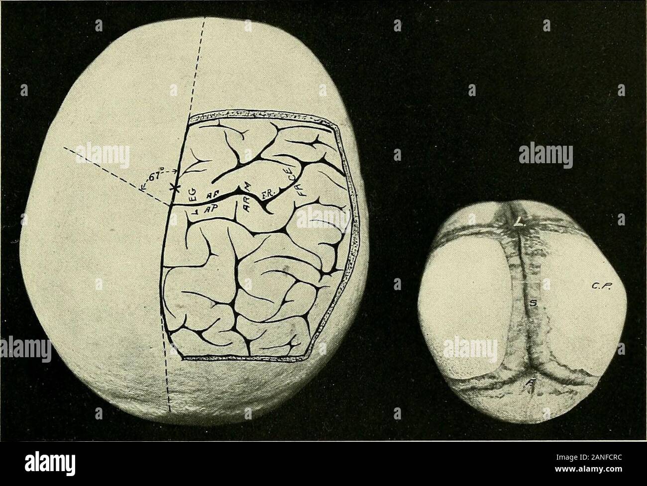 Dolichocephalic hi-res stock photography and images - Alamy