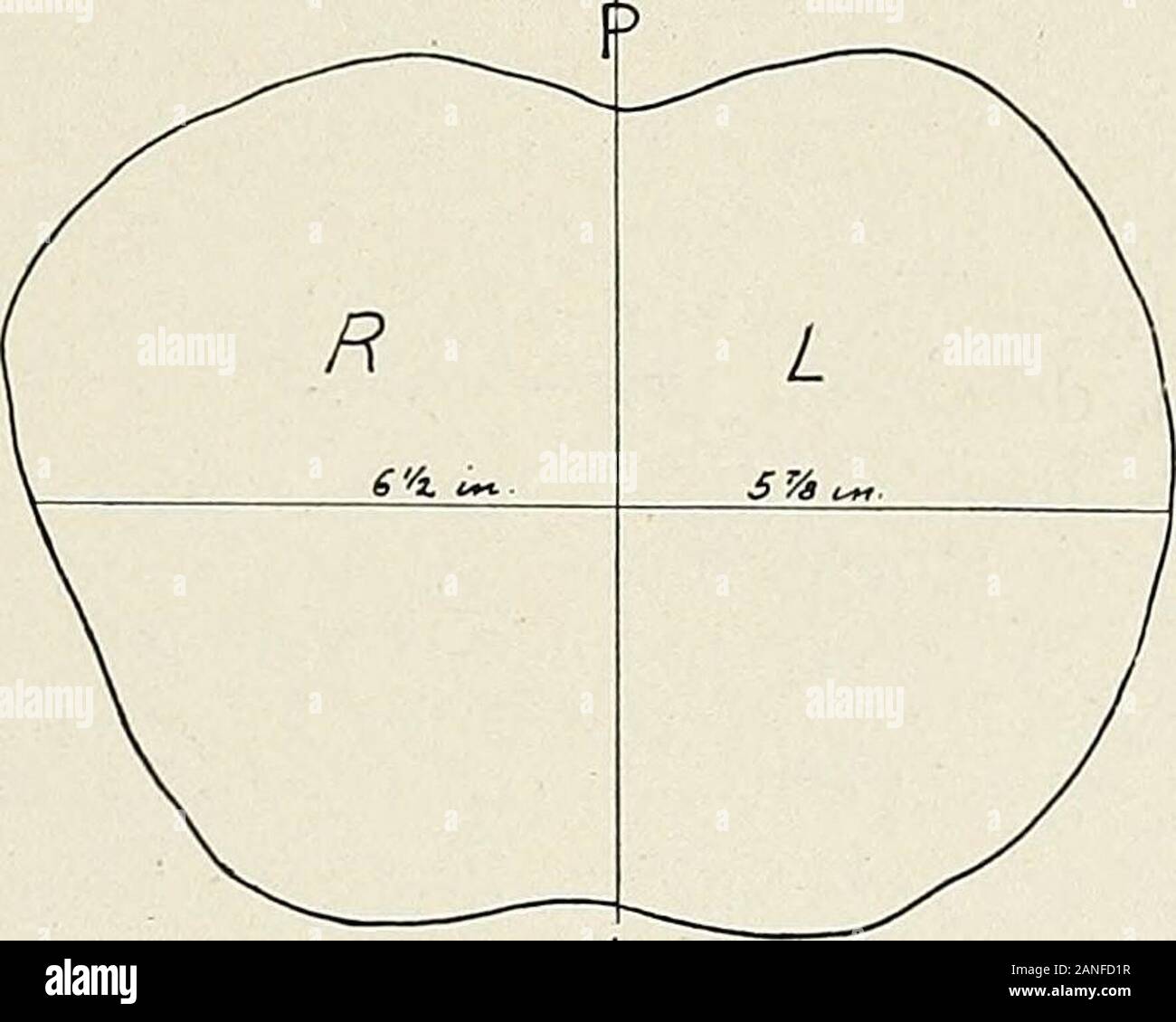 Diseases of the chest and the principles of physical diagnosis . A Fig ...