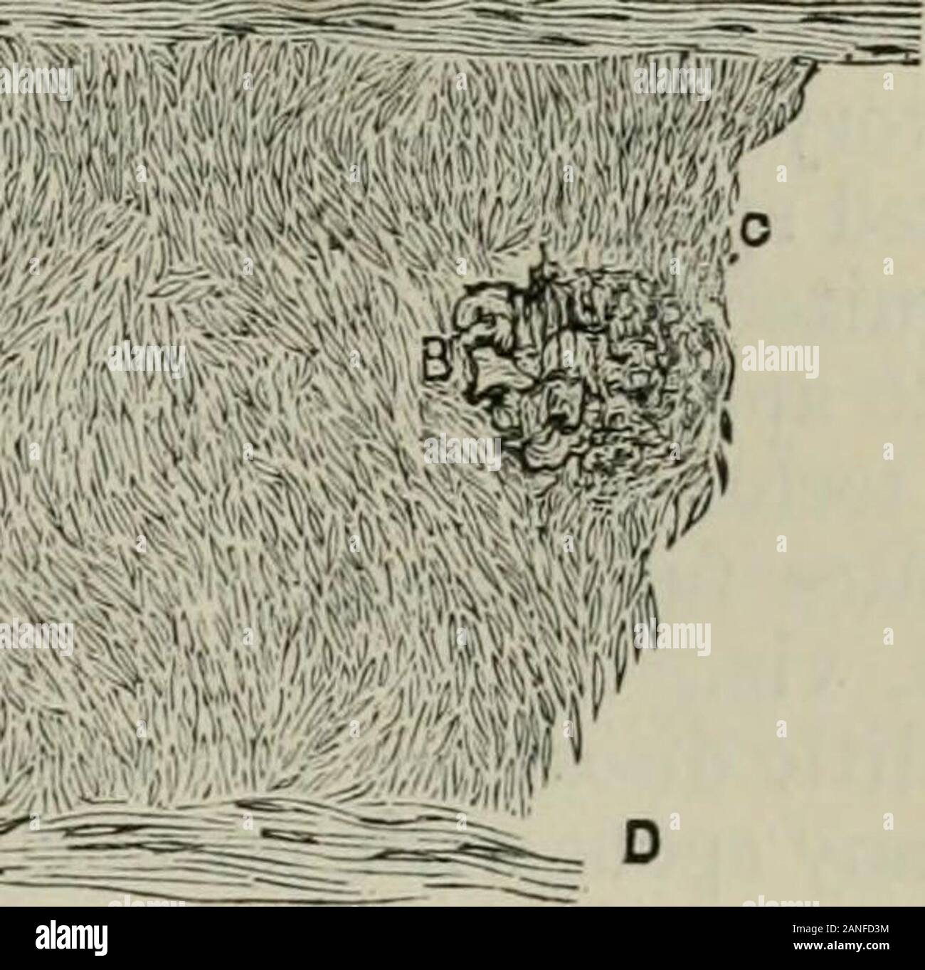 Calcifica hi-res stock photography and images - Alamy