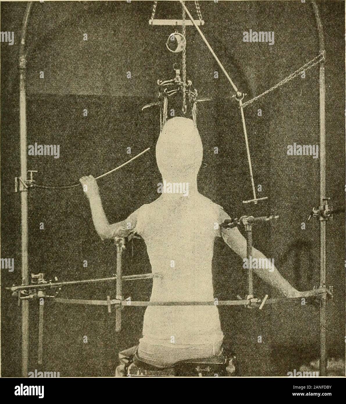 Traction spine traction hi-res stock photography and images - Alamy