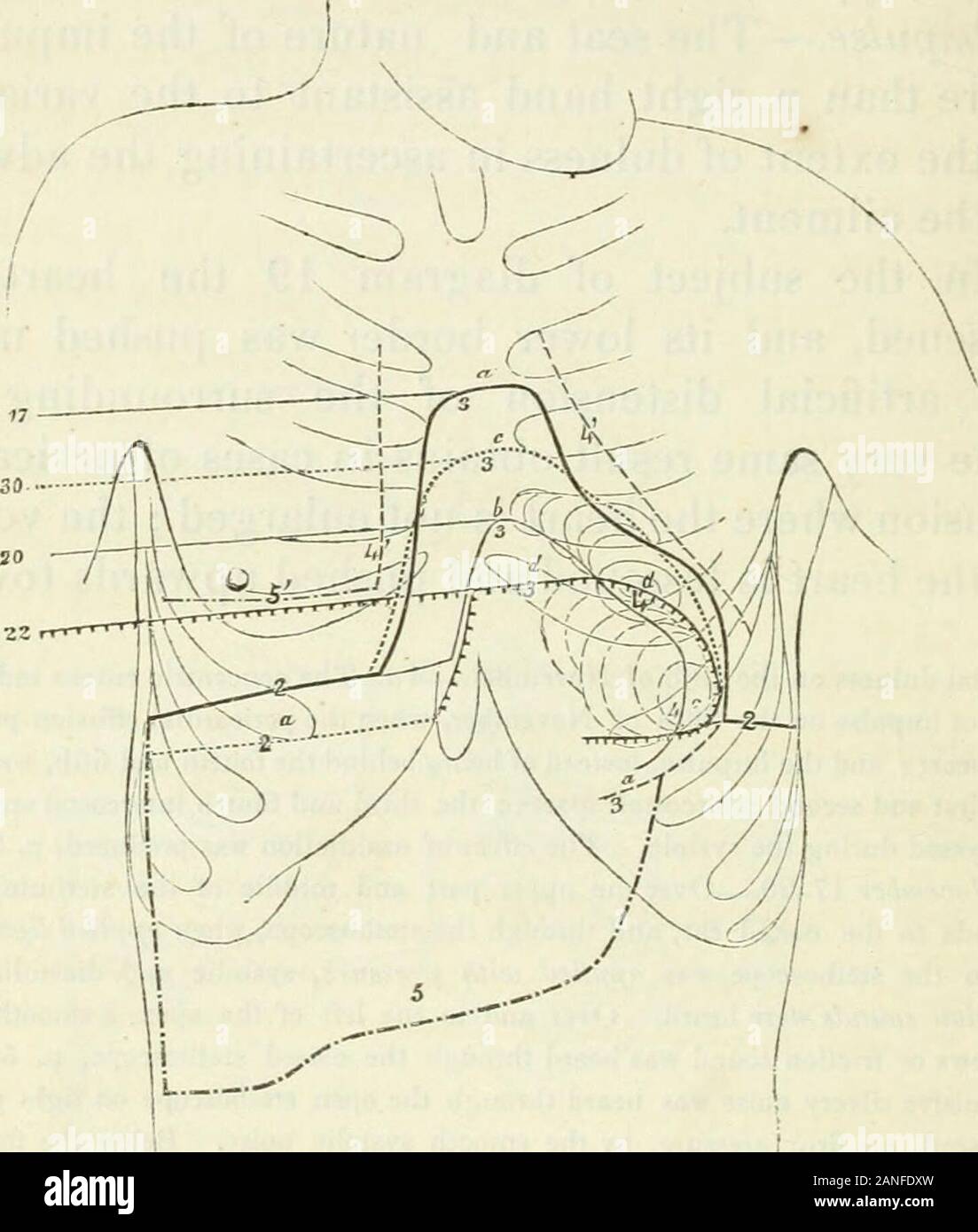 Transactions . er boundary of pericardial dulness on the 24th of ...