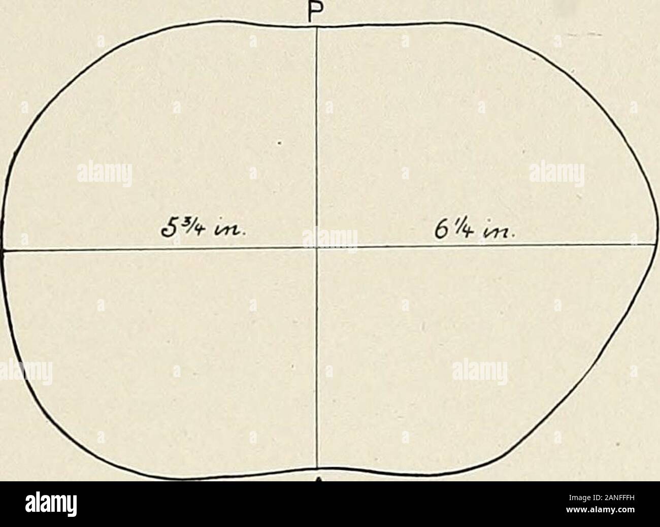 Diseases of the chest and the principles of physical diagnosis . ntero ...