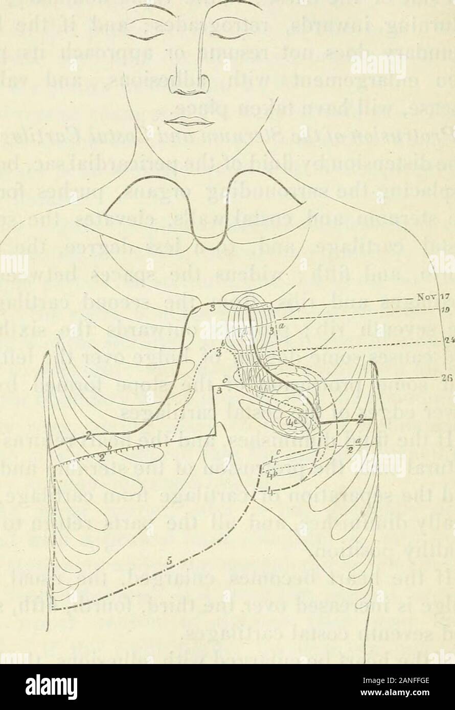 Costal cartilages hi-res stock photography and images - Alamy
