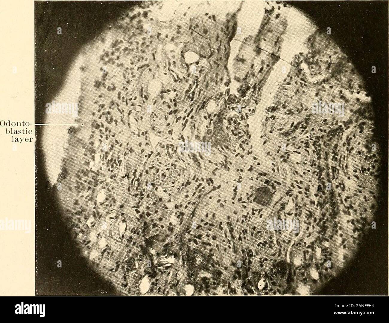 Principles and practice of operative dentistry . Fig. 183.—Section of ...