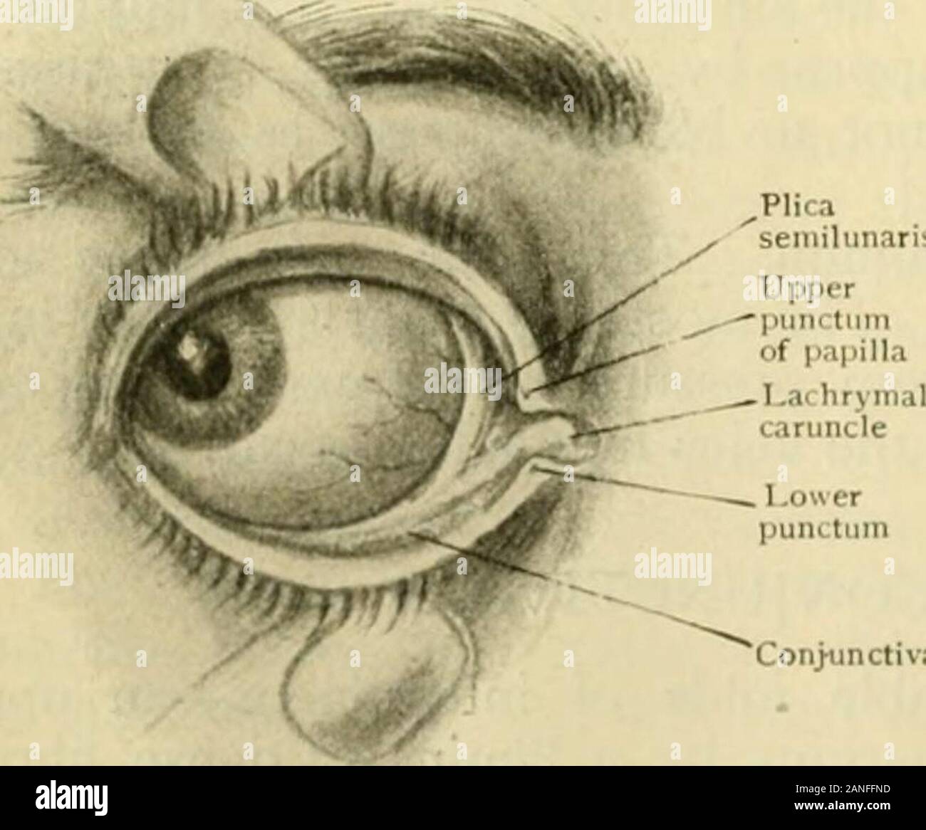 Tarsal Eye