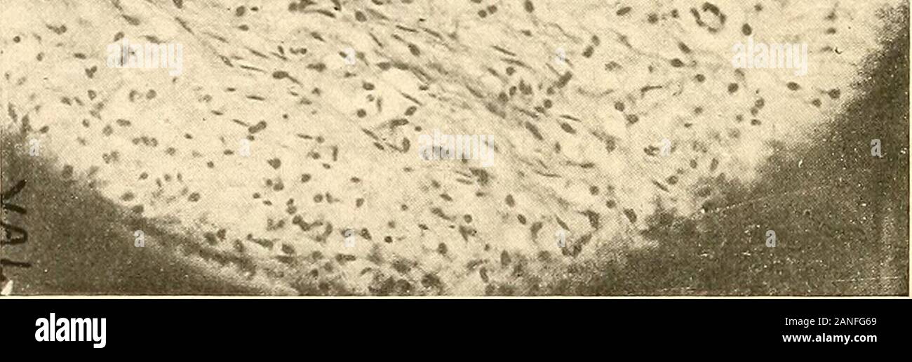 Pulp tissue hi-res stock photography and images - Alamy