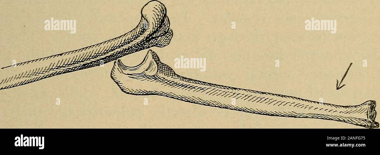 Atlas and epitome of traumatic fractures and dislocations . Fig. 83 ...