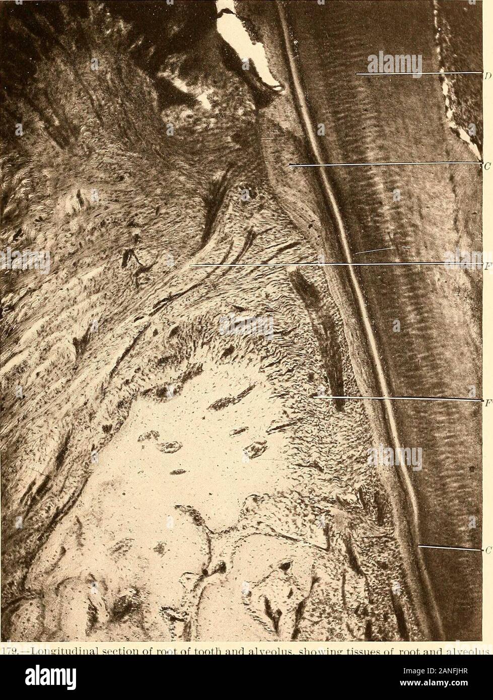 Principles and practice of operative dentistry . Fig. 178.—Transverse ...