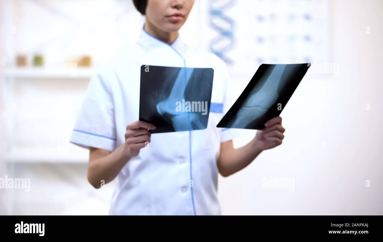 Doctor in uniform checking bones x-rays trauma and rehabilitation ...