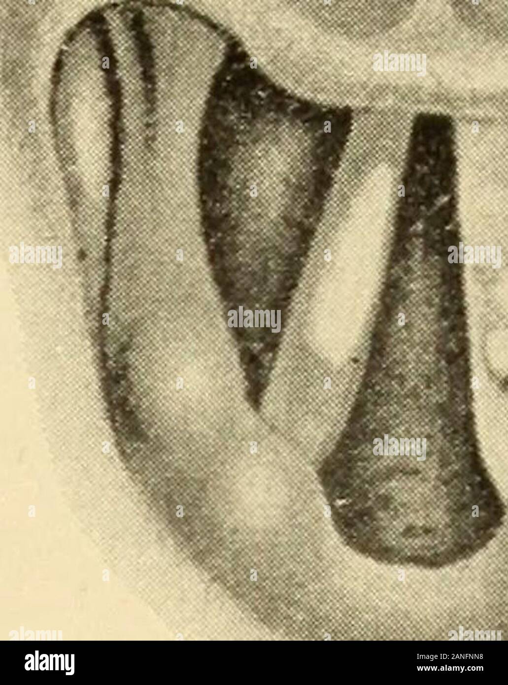A text-book on diseases of the ear, nose and throat . arynx, especially ...