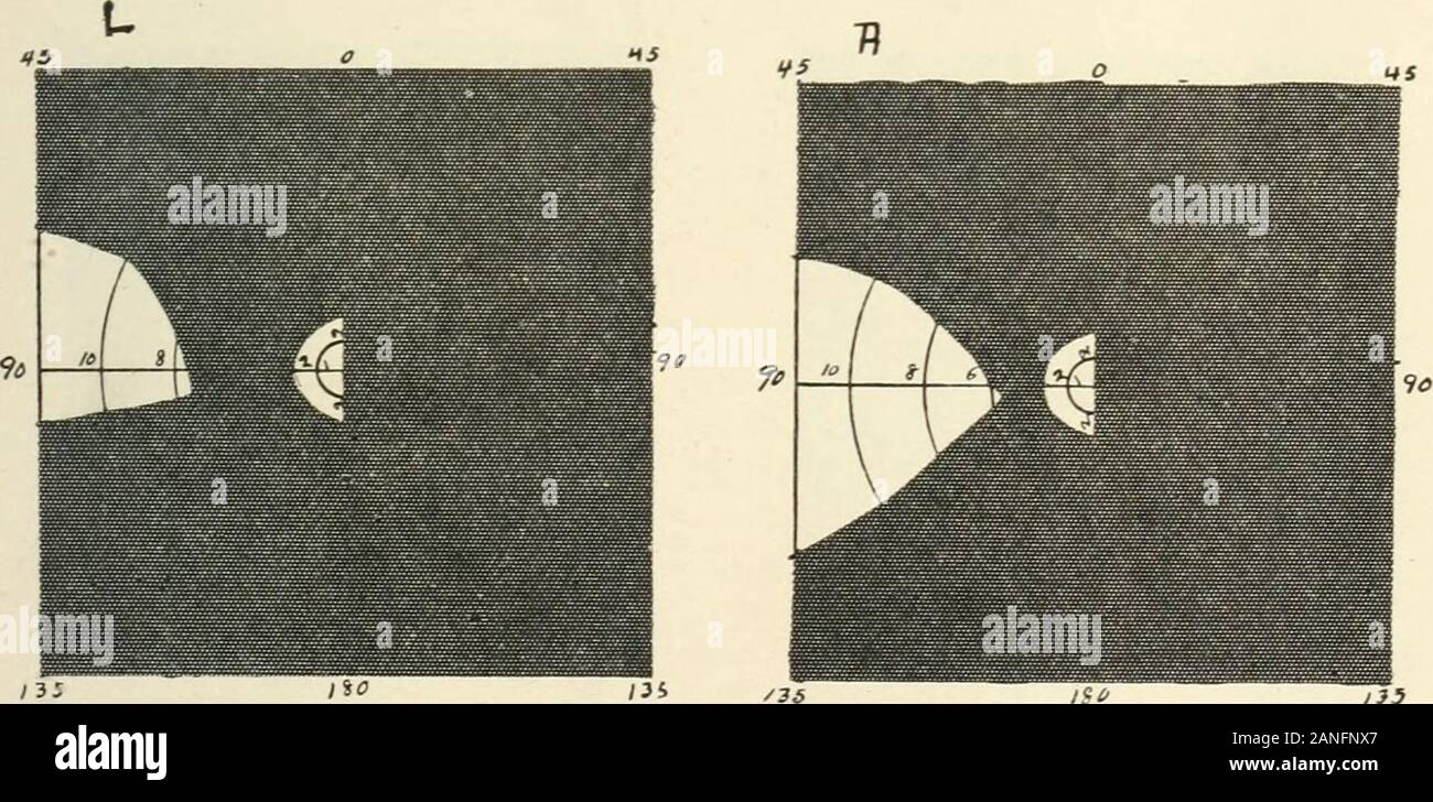 AMAarchives of neurology & psychiatry . Fig. 9 (Case 9. L. S.).—Left ...
