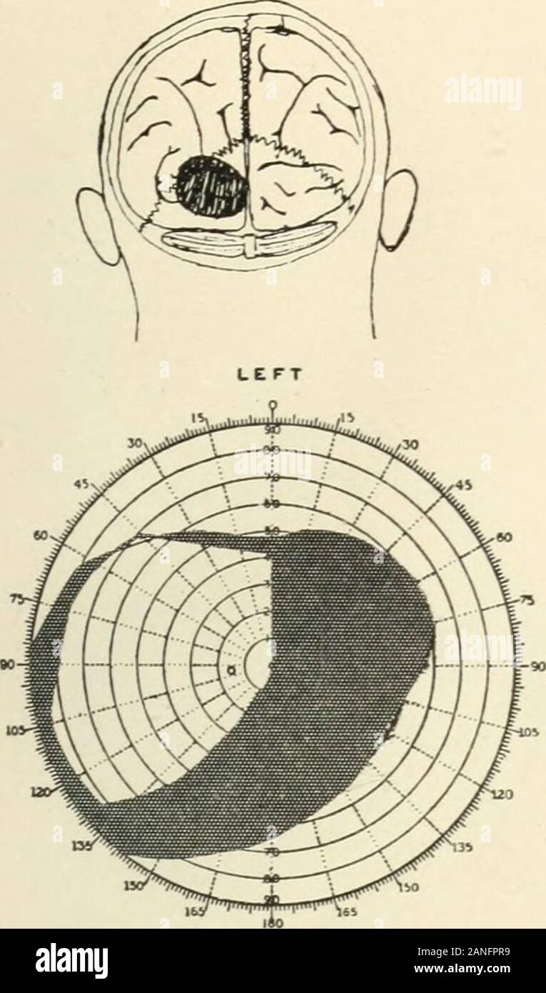 AMAarchives of neurology & psychiatry . Fig. 8 (Charts 8, F. D.).—Right ...