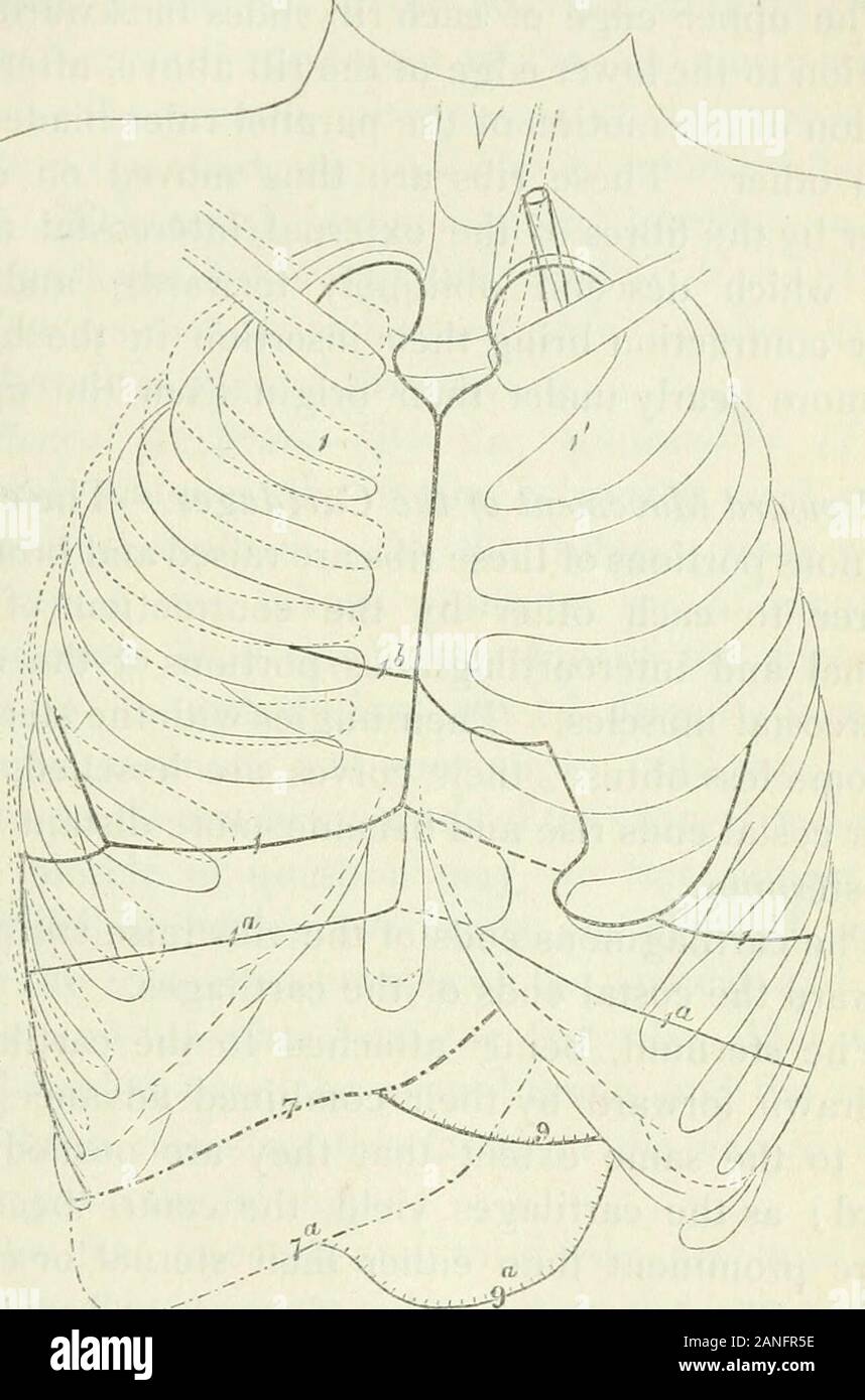 Transactions . medbetween the cartilage and rib, becomes a straightline ...