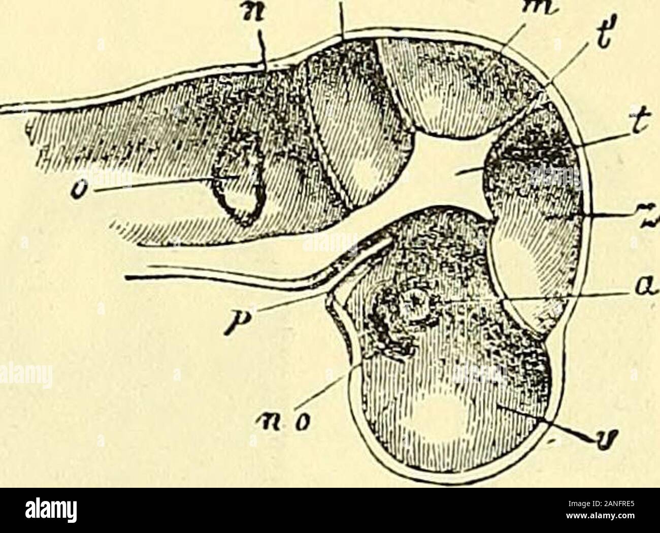 Cranial modification hi-res stock photography and images - Alamy