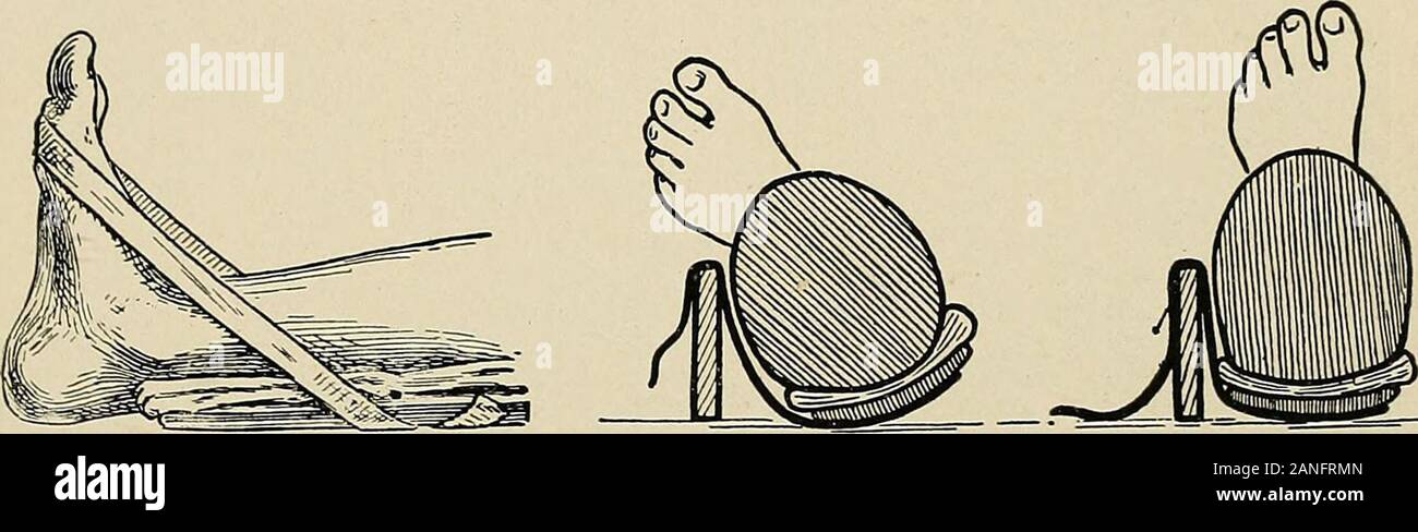 The practice of surgery . 03 through outwiird rolution of tlic Ici ...