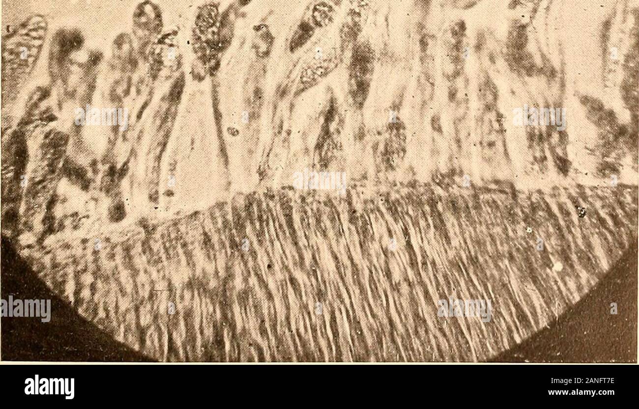 Principles and practice of operative dentistry . ?apillii Fig. 171 ...