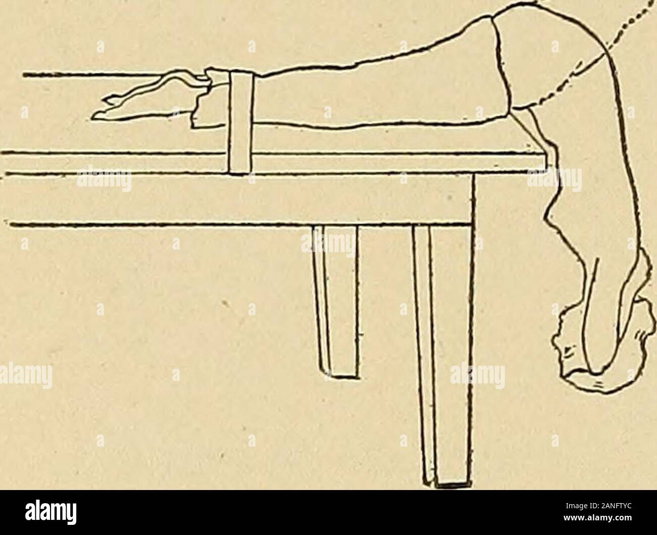 Lateral curvature of the spine hi-res stock photography and images - Alamy