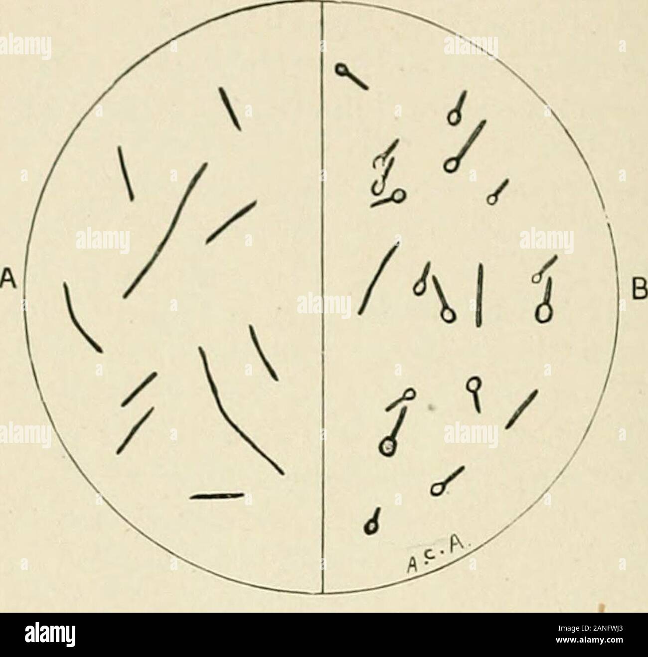 Tetanus Wound Symptoms