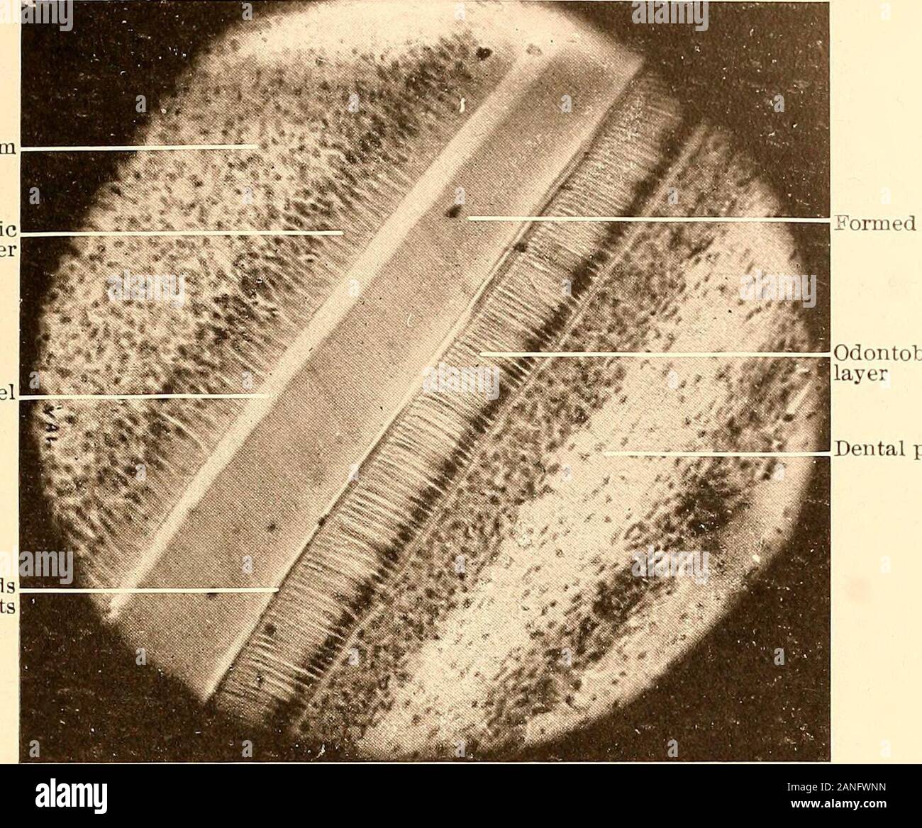 Principles and practice of operative dentistry . by Tomes under three ...