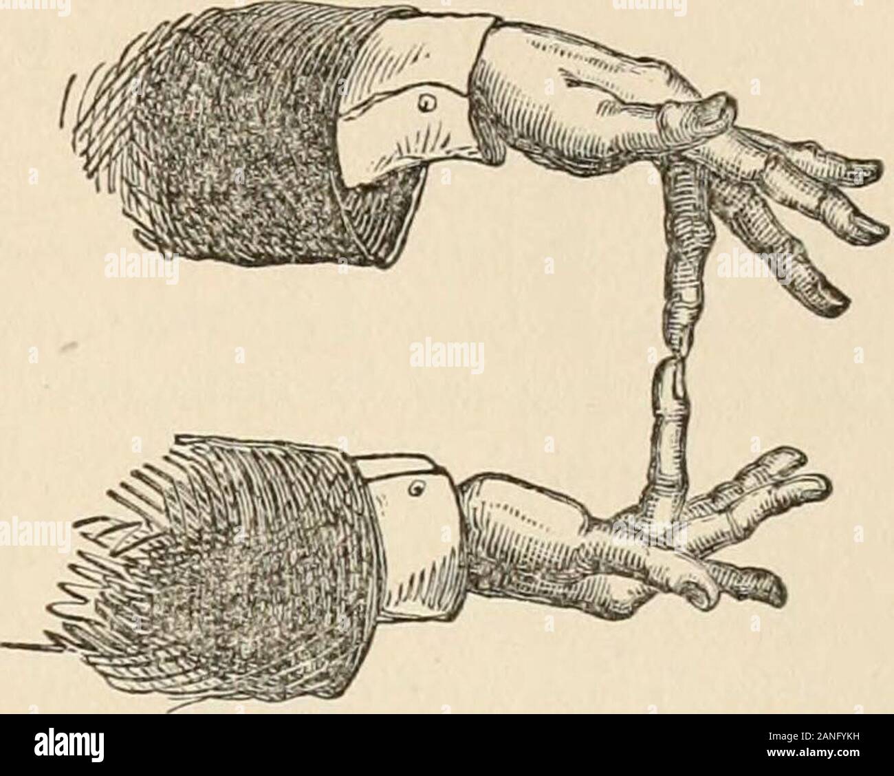 Conjoined hands hi-res stock photography and images - Alamy