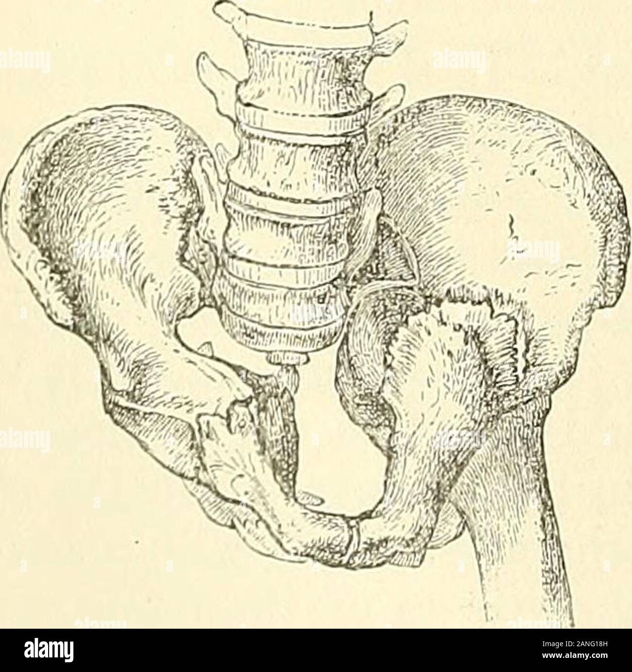 Acetabular cavity hi-res stock photography and images - Alamy