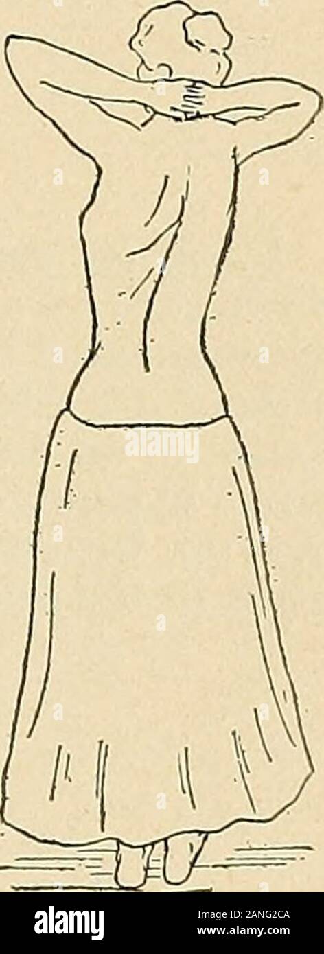 Lateral curvature of the spine and round shoulders . Fig. 95. Fig. 96 ...