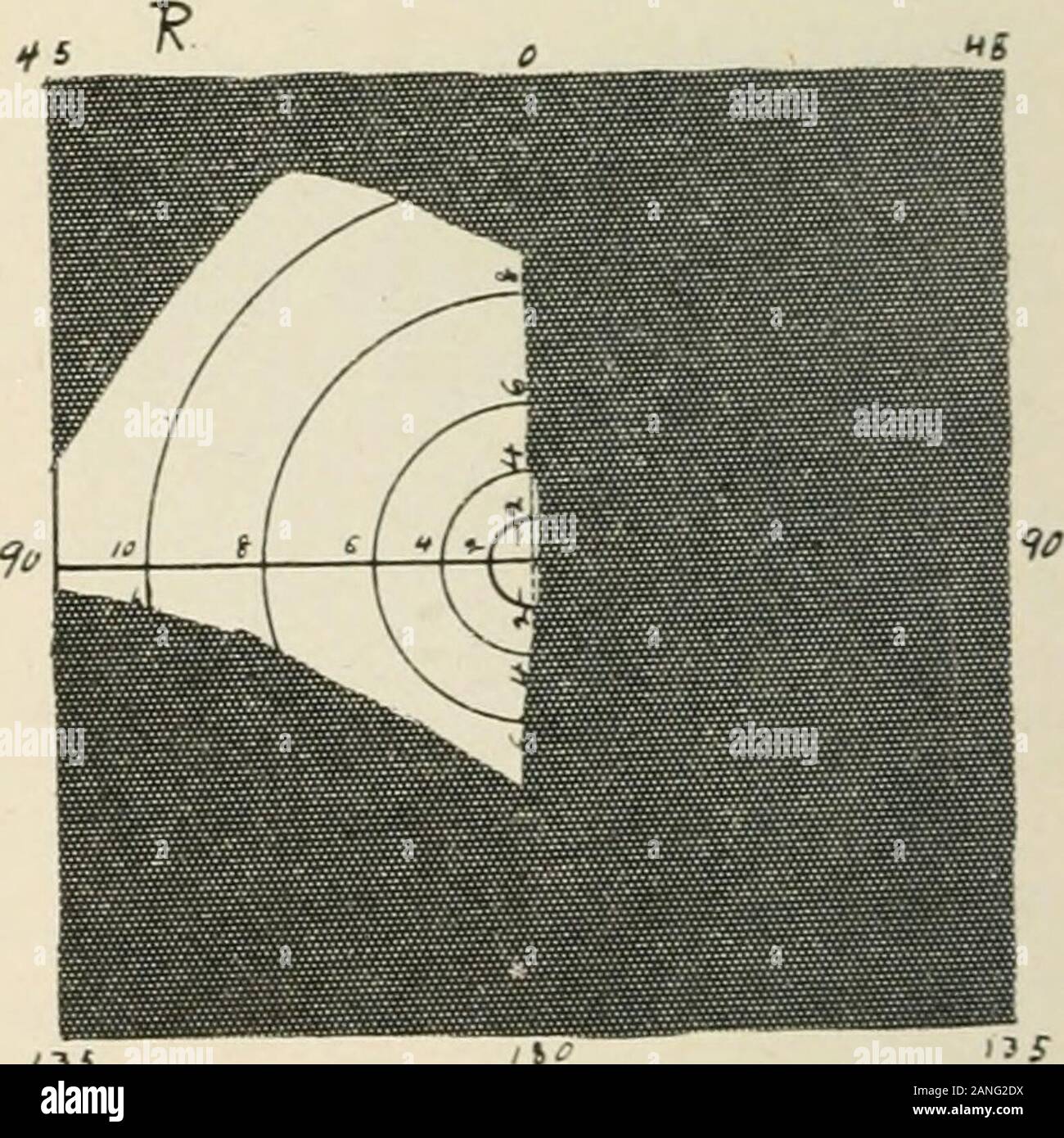 AMAarchives of neurology & psychiatry . Fig 2 (Case 2, W. C.).—Wound ...