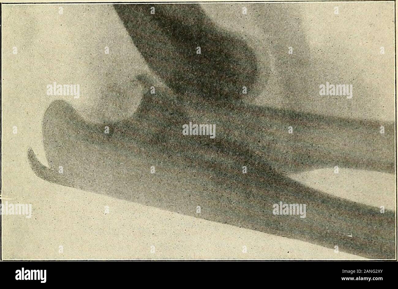 A text-book of first aid and emergency treatment . Fig. 98.—Anterior ...