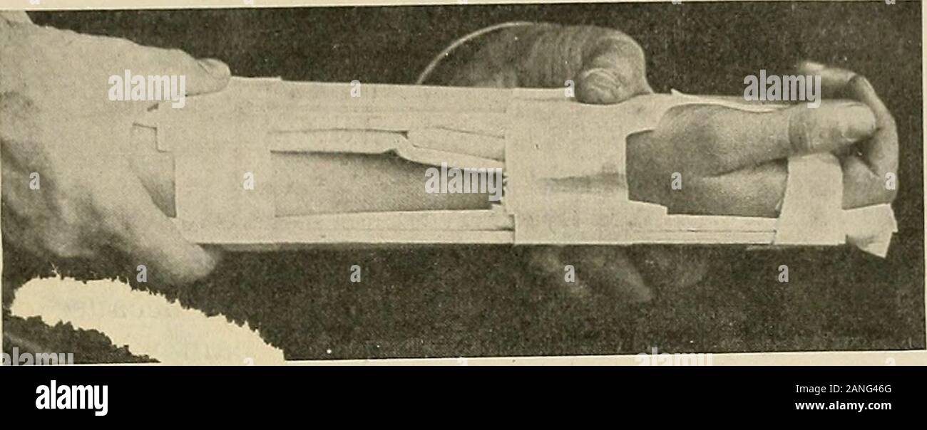 Narrow wrist hi-res stock photography and images - Alamy