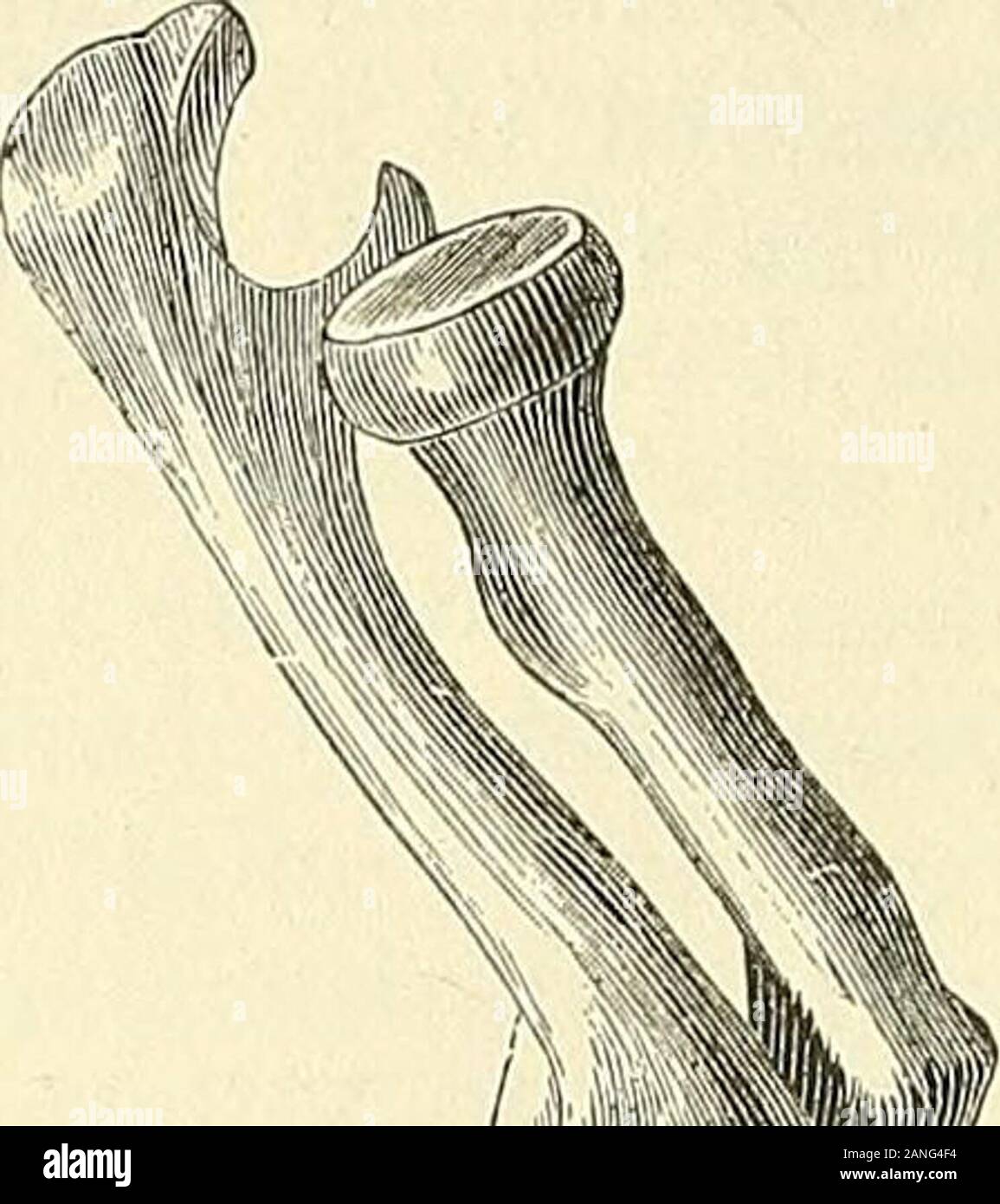 Comminuted radius and ulna hi-res stock photography and images - Alamy Comminuted radius and ulna hi-res stock photography and images - Alamy