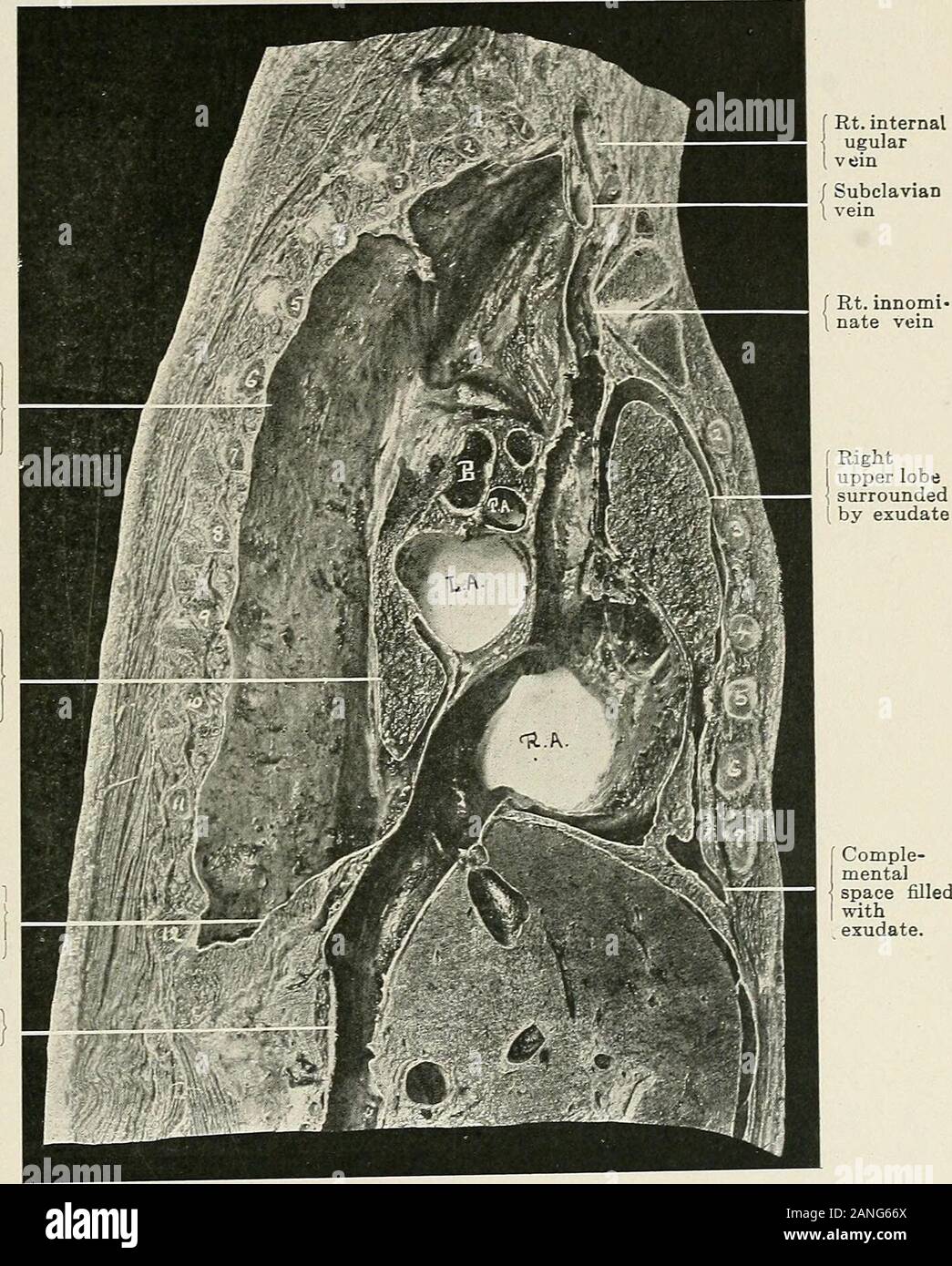 Epigastrium hi-res stock photography and images - Alamy