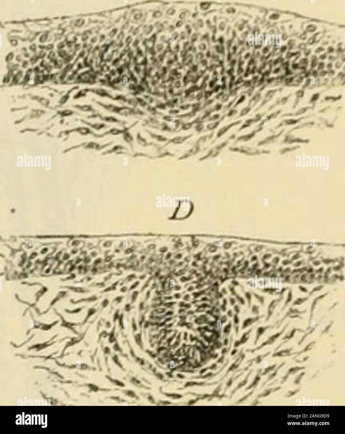 Human skin showing hair follicles hi-res stock photography and images ...