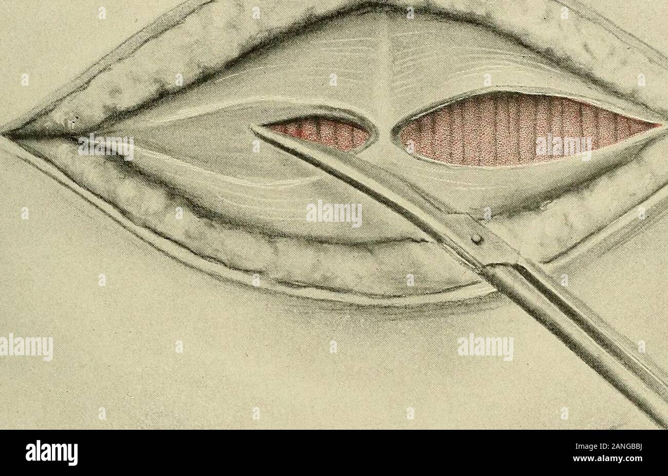 Transverse cuts hi-res stock photography and images - Alamy