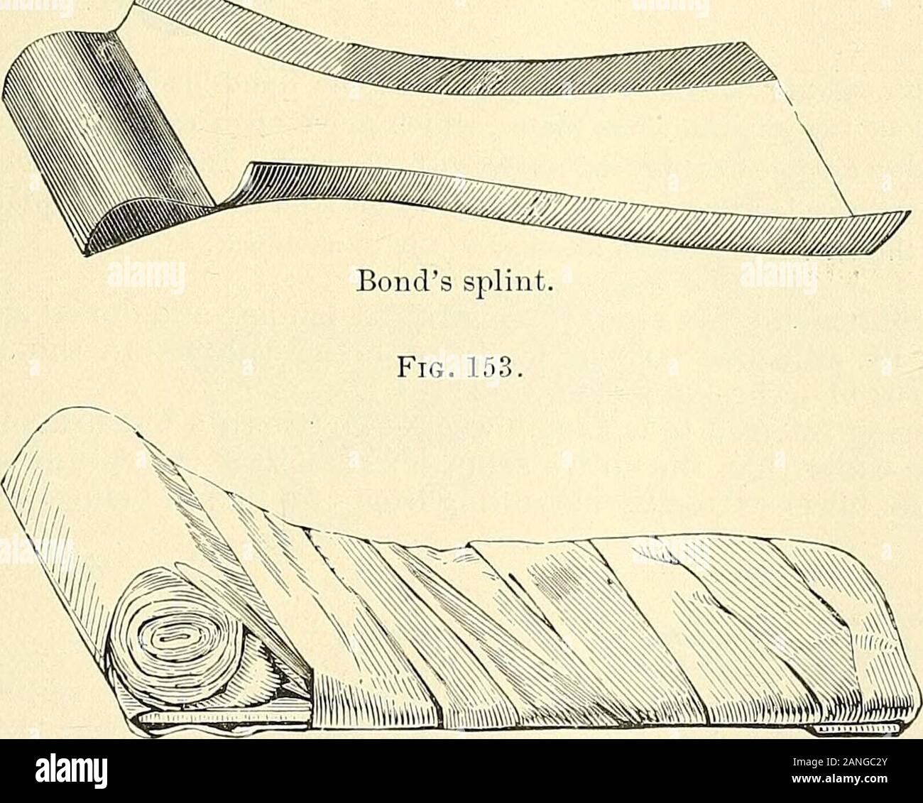 A practical treatise on fractures and dislocations . Nelatons splint ...