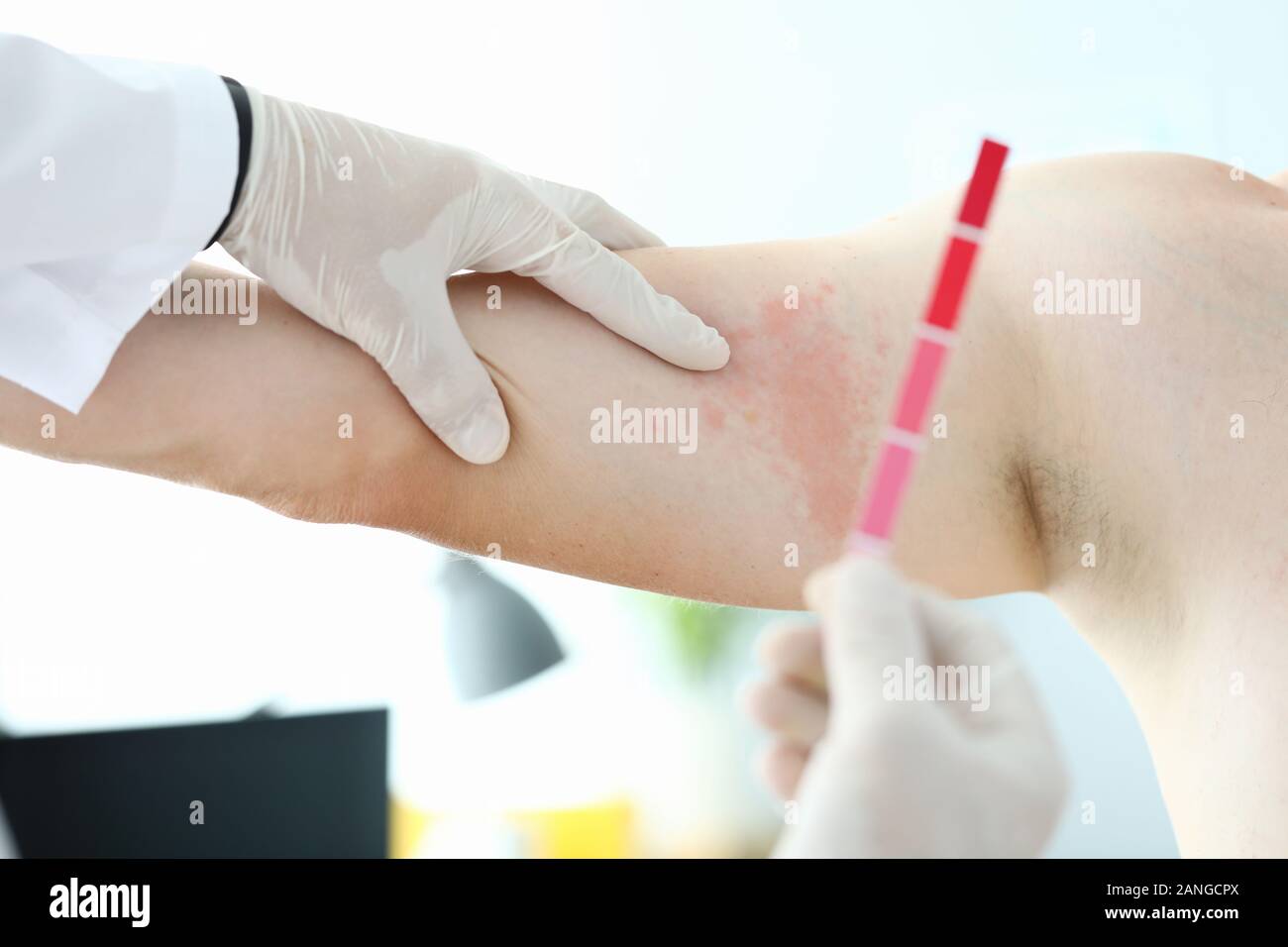 Choosing skin treatment method concept Stock Photo - Alamy
